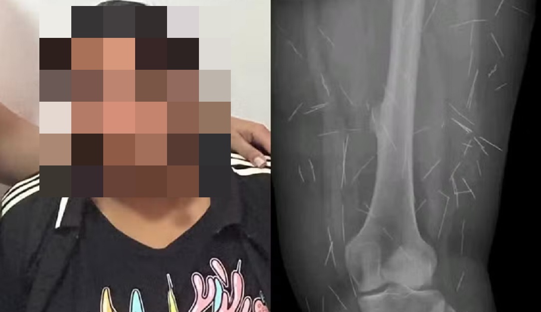 Mulher que fingiu ter 12 anos já havia alegado abusos e chamado atenção ...